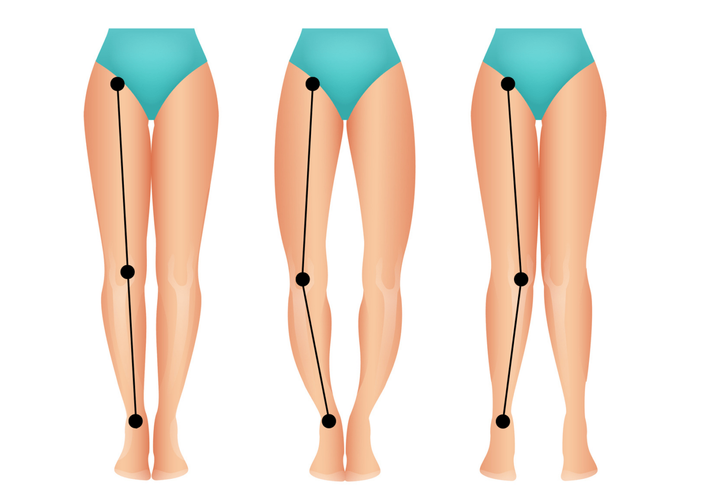 Beinachsentraining nach dem Kreuzbandriss – in der Reha Pflicht